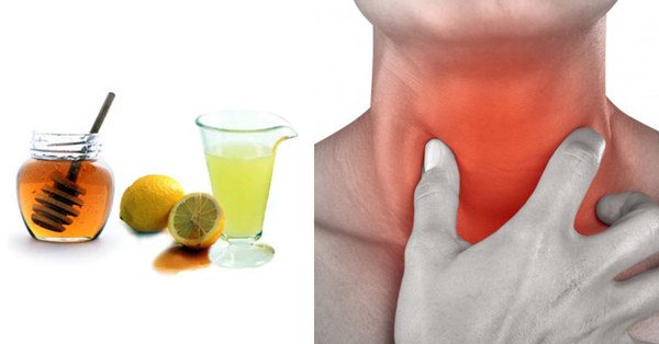 Cure Your Strep Throat In Just One Day Without Taking Any Antibiotics